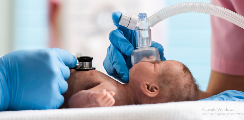 How a Neonatal T-piece Resuscitator Helps Preemies